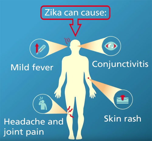 Florida Department of Health, Brevard County Zika Virus Update - Space ...