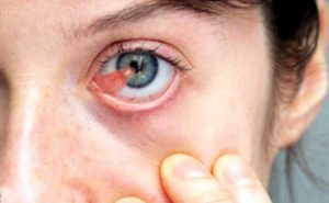 Dr. Rafael Trespalacios: You Don’t Have to Ride the Waves to Suffer ...